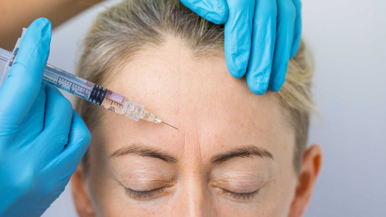 Botox Full Face: O Que é, Áreas Tratadas, Benefícios e Mais