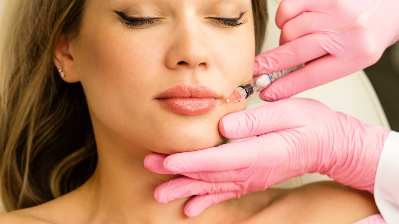 Quais São as Fases do Preenchimento Labial?